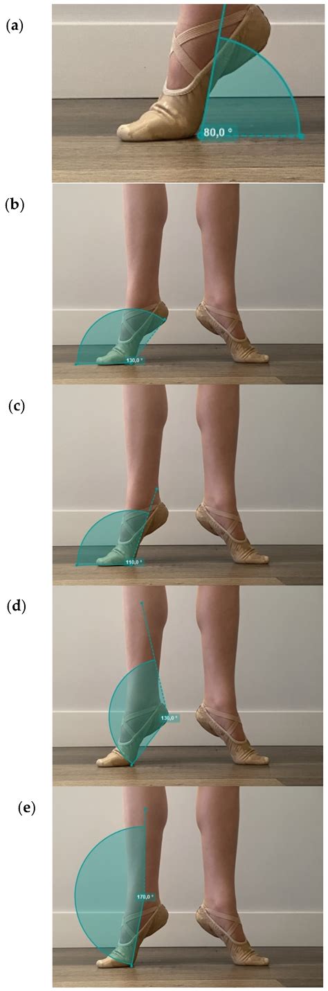 Design Of A Lower Limb Prosthesis For Ballet Practice