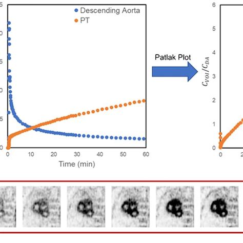 The Dynamic ¹⁸f Fdg Uptake Of Pt Within 60 Min After The Injection In Download Scientific
