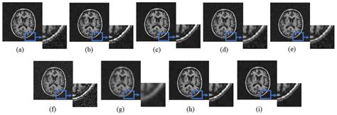 Denoising By Different Algorithms On Real Mri Brain Scans 42 A Download Scientific Diagram