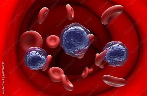 Acute Myeloid Leukemia Aml Cells In Blood Flow Section View 3d