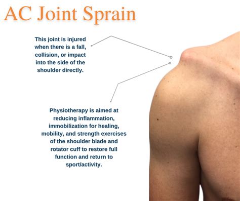 The Ac Joint Aurora Sports Medicine Professionals Inc Facebook