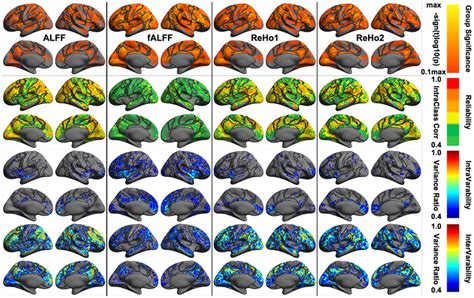 Vertex Wise Statistical Maps Of Four Common Rfmri Metrics At Local