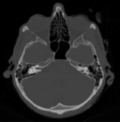 An Example Of Head Image Obtained From CT Scan Imaging Download Scientific Diagram