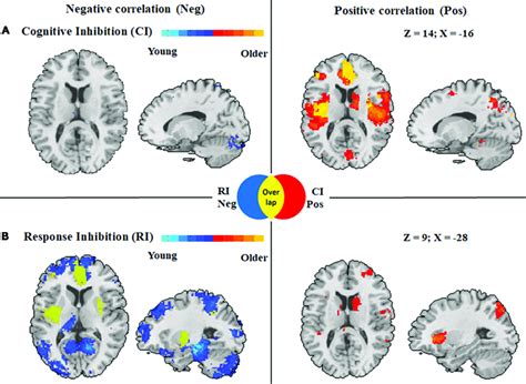 activation maps displaying whole brain regression analysis in cognitive