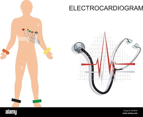 Illustration Of The Electrocardiogram The Patient With Electrodes On