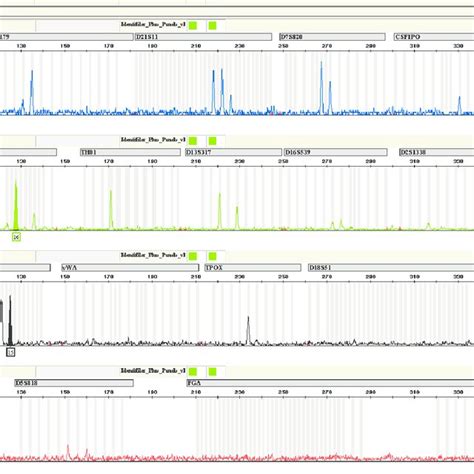 D Electropherogram Showing The Identifiler Plus Str Profile For The