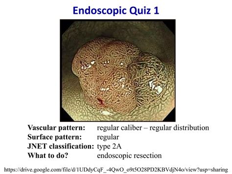 Jnet Classification Of Colo Rectal Polyps Pptx Medical Health