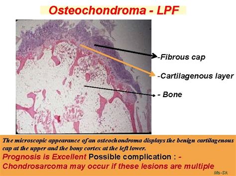 Musculoskeletal Block Pathology Of Musculoskeletal System Practical Classes