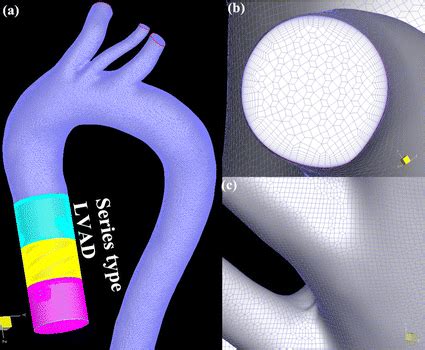 The Finite Element Model Used In This Study Download Scientific Diagram