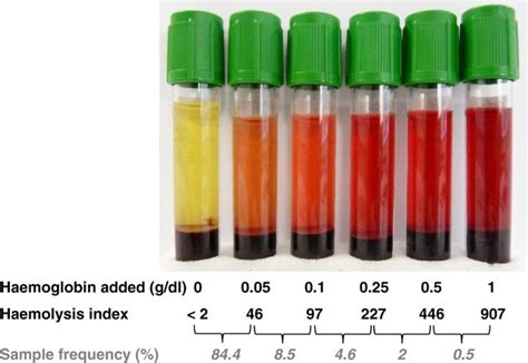 Why Do Blood Specimens Hemolyze At Jason Criner Blog