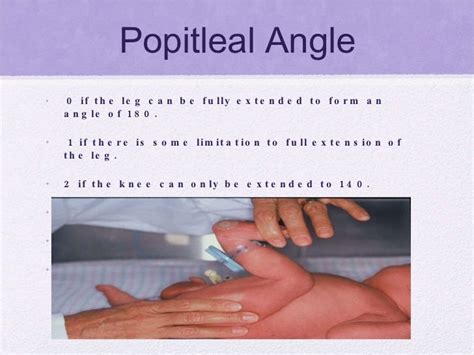 Newborn Health Assessment
