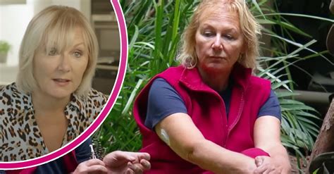 Im A Celebrity Sue Cleaver Fans Making Same Complaint