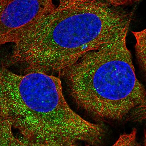 Rabbit Polyclonal Anti Ntpcr Antibody Buy For Research Highly Specific Rigorously Validated