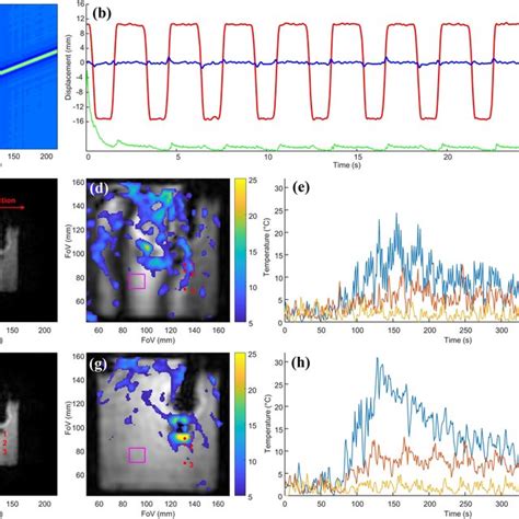 Motion Detection And Effect Of The Motion Correction On Magnitude Download Scientific Diagram