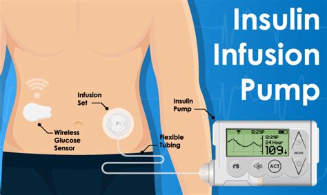New Technology Allows Next Gen Portable Battery Operated Iot Devices