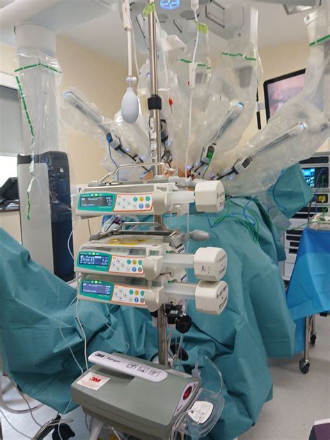 Patricija Ecimovic On Linkedin Setup For Gyne Cancer Robotic Assissted Surgery In A Patient