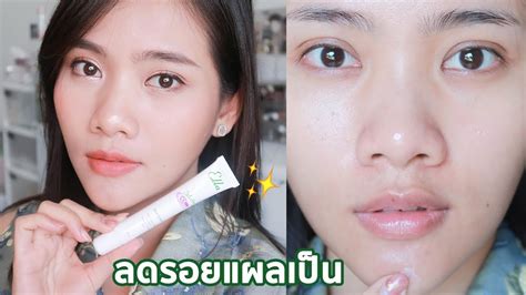 ครีมลดรอยแผลเป็น ที่ขายดีที่สุด 5 ปี ซ้อน Youtube