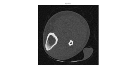 Matlab Detecting And Isolating Part Of An Image Signal Processing