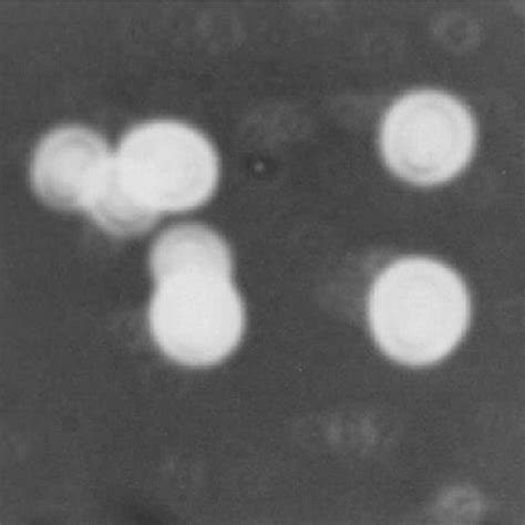 Pdf Subcutaneous Cryptococcosis Due To Cryptococcus Diffluens In A