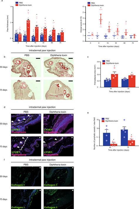 Diphtheria Toxin Induces Experimental Secondary Lymphedema Development Download Scientific