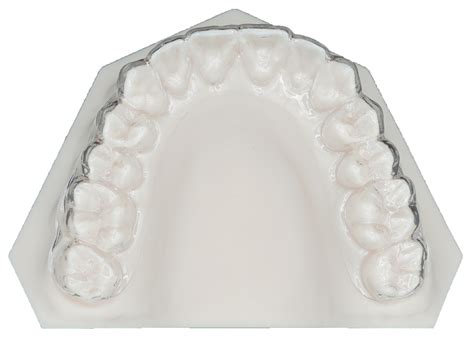 Essix Retainer Protec Dental