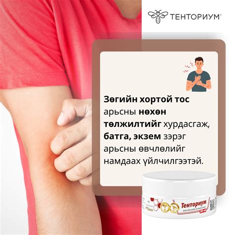 Тенториум Арьсны өвчлөлд зөгийн хор хэрхэн үйлчилдэг вэ Зөгийн