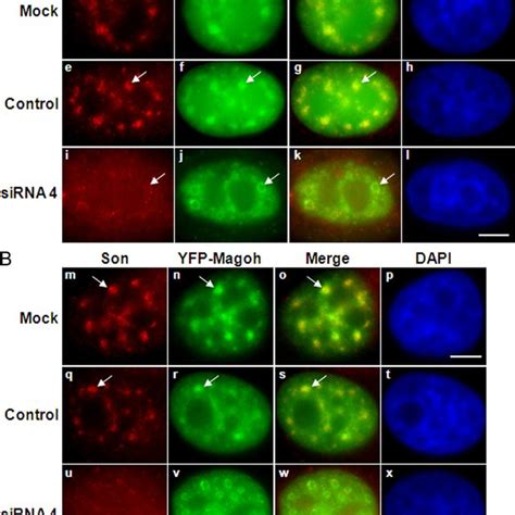 Sirna Mediated Depletion Of Son Alters The Localization Of Nuclear Download Scientific Diagram