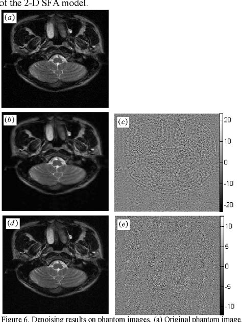 Figure 6 From Magnetic Resonance Image Denoising Using Spectral Data Substitution Semantic Scholar