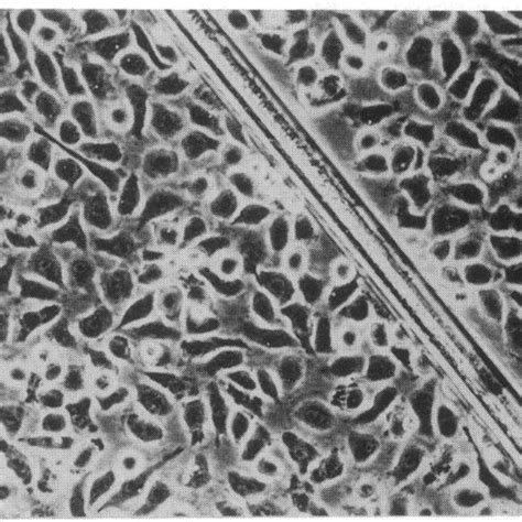 Intercellular Gap Junctional Communication In Rat 13762nf Mammary