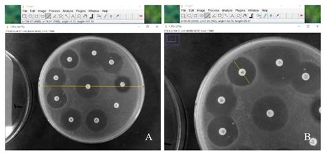 Enterococcus Faecalis Infection