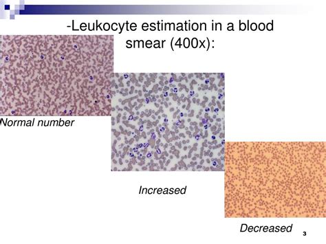 PPT Leukocyte Total And Differential Count PowerPoint Presentation Free Download ID 1256992