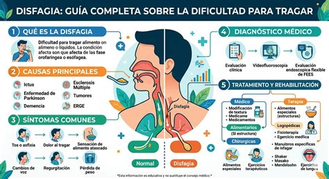 Disfagia Guia Completa