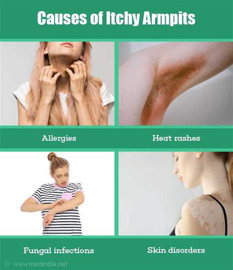 How To Treat Itchy Rash On Armpit at Lois Lumpkin blog