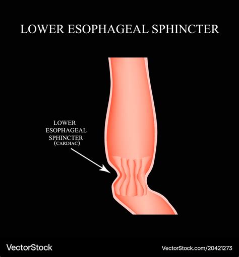 Lower Esophageal Sphincter Cardiac Sphincter I Generally See