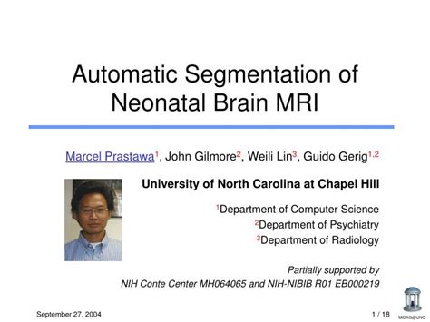 Ppt Automatic Segmentation Of Neonatal Brain Mri Powerpoint Presentation Id 735917