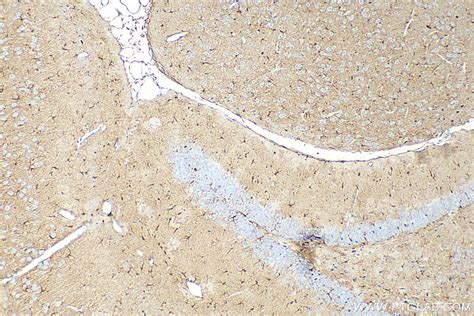 S100b Antibody 15146 1 Ap Proteintech