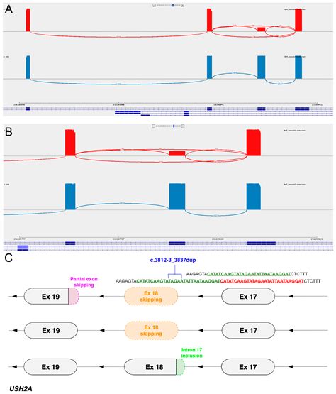 Investigating Splice Defects In Ush2a Using Targeted Long Read Sequencing