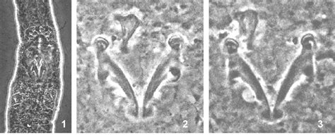 Haplognathia Asymmetrica 2 1 Pharyngeal Region 2 2 2 3 Basal Plate Download Scientific