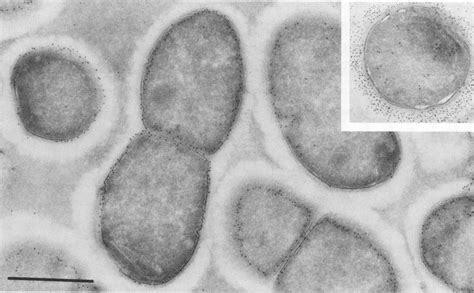 Streptococcus Salivarius Morphology Full Article Synbiotic Musa