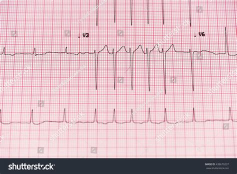 Ekg Graph Stock Photo Shutterstock