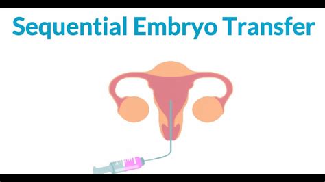 Sequential Embryo Transfers Youtube