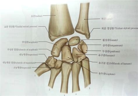 주상골골절손배뼈의 증상과 치료 네이버 블로그
