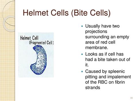 Ppt Mlab 1415 Hematology Keri Brophy M Artinez Powerpoint