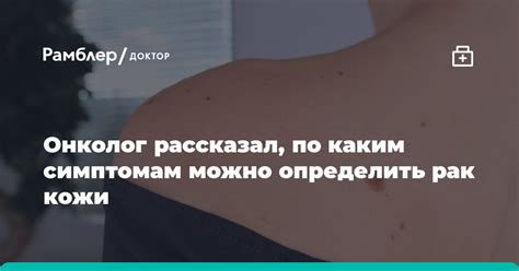 Онколог рассказал по каким симптомам можно определить рак кожи Рамблер здоровье