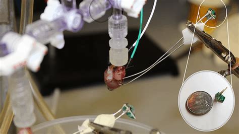 Grant To Develop Wireless Leadless Pacemaker Todays Medical