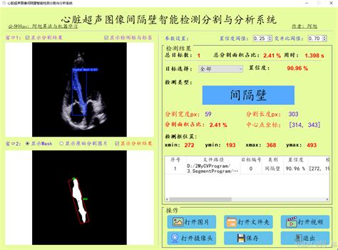 基于yolo11深度学习的心脏超声图像间隔壁检测分割与分析系统【python源码pyqt5界面数据集训练代码】深度学习实战、目标分割、人工智能人工智能阿旭 Damo开发者矩阵