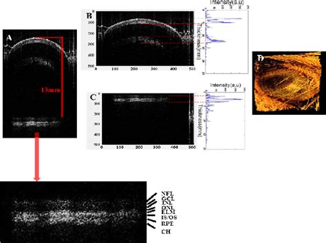 A Conventional Sd Oct Image Of Cornea And Lens Abbreviations Nfl Download Scientific