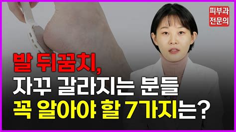 발 굳은살 관리 피부과 전문의의 전문가 조언