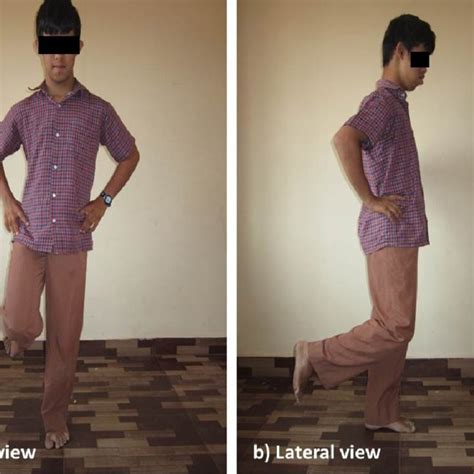Standing Static And Dynamic Balance Tests Mean And Median Scores In Download Table