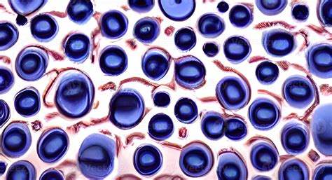 Realistic Microscopic Viruses Of Various Shape On Blue Blurred